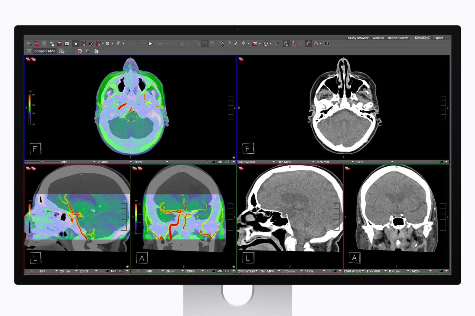 DICOM Medical Imaging Comes to Studio Display XDR - AppleMagazine